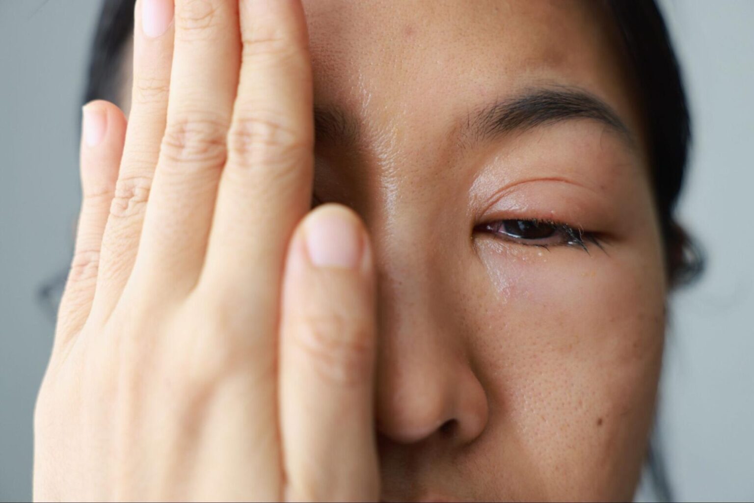 Eye Injuries Treatment In Singapore - Eye Specialist Centre